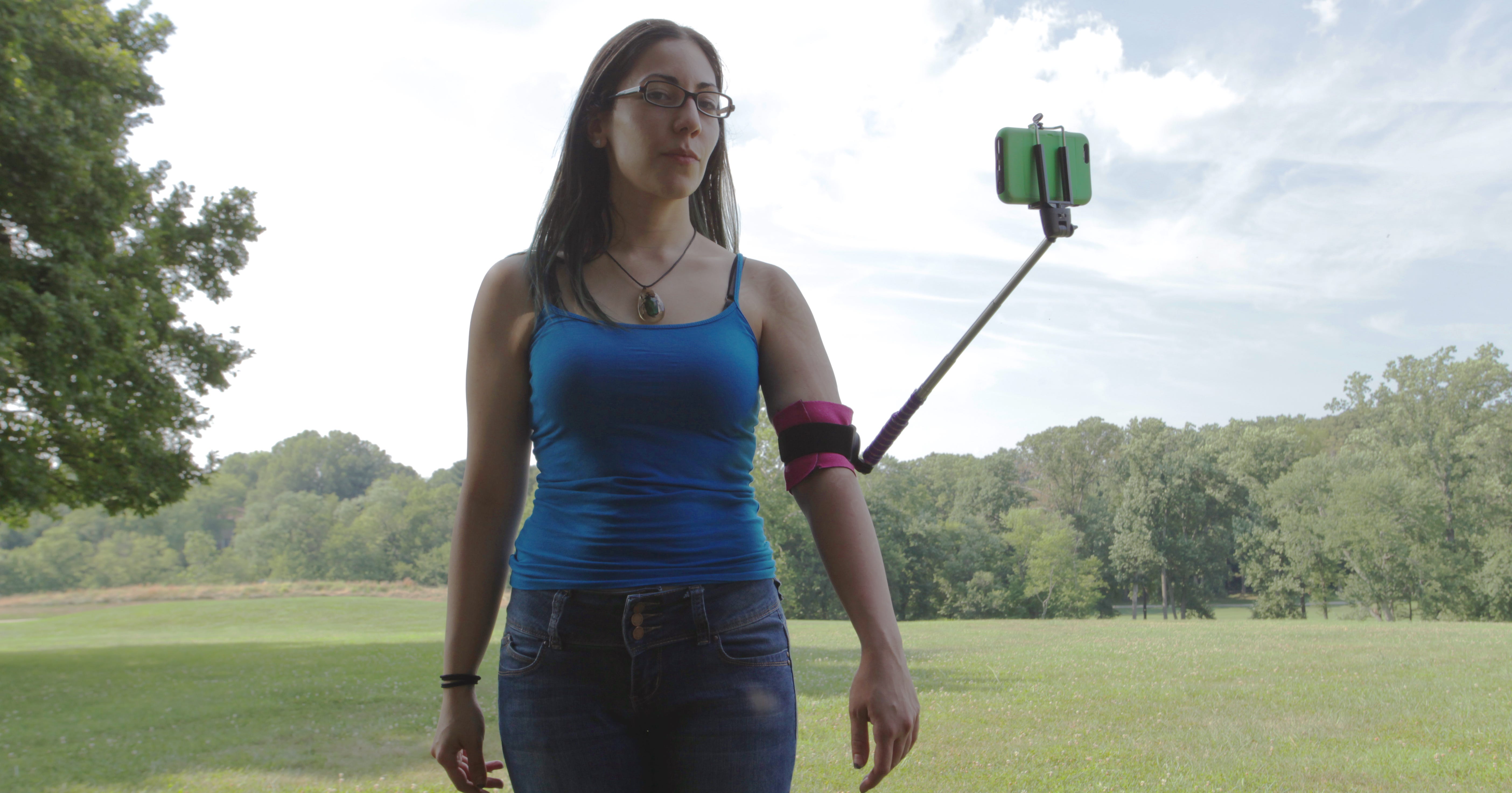 Prosthetic Arm Design Challenge Project Unicorn