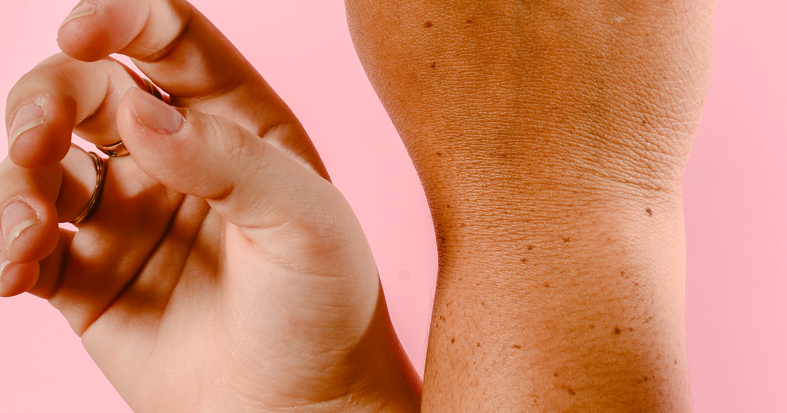 Nimco Ali - Social Activist, Female Genital Mutilation