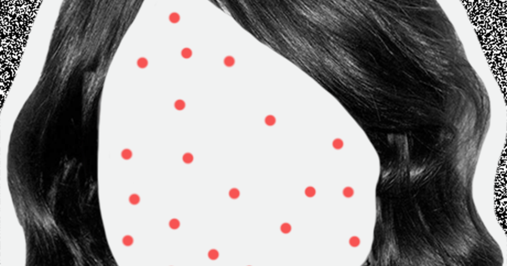 Acne Sufferers Live Longer And Look Younger