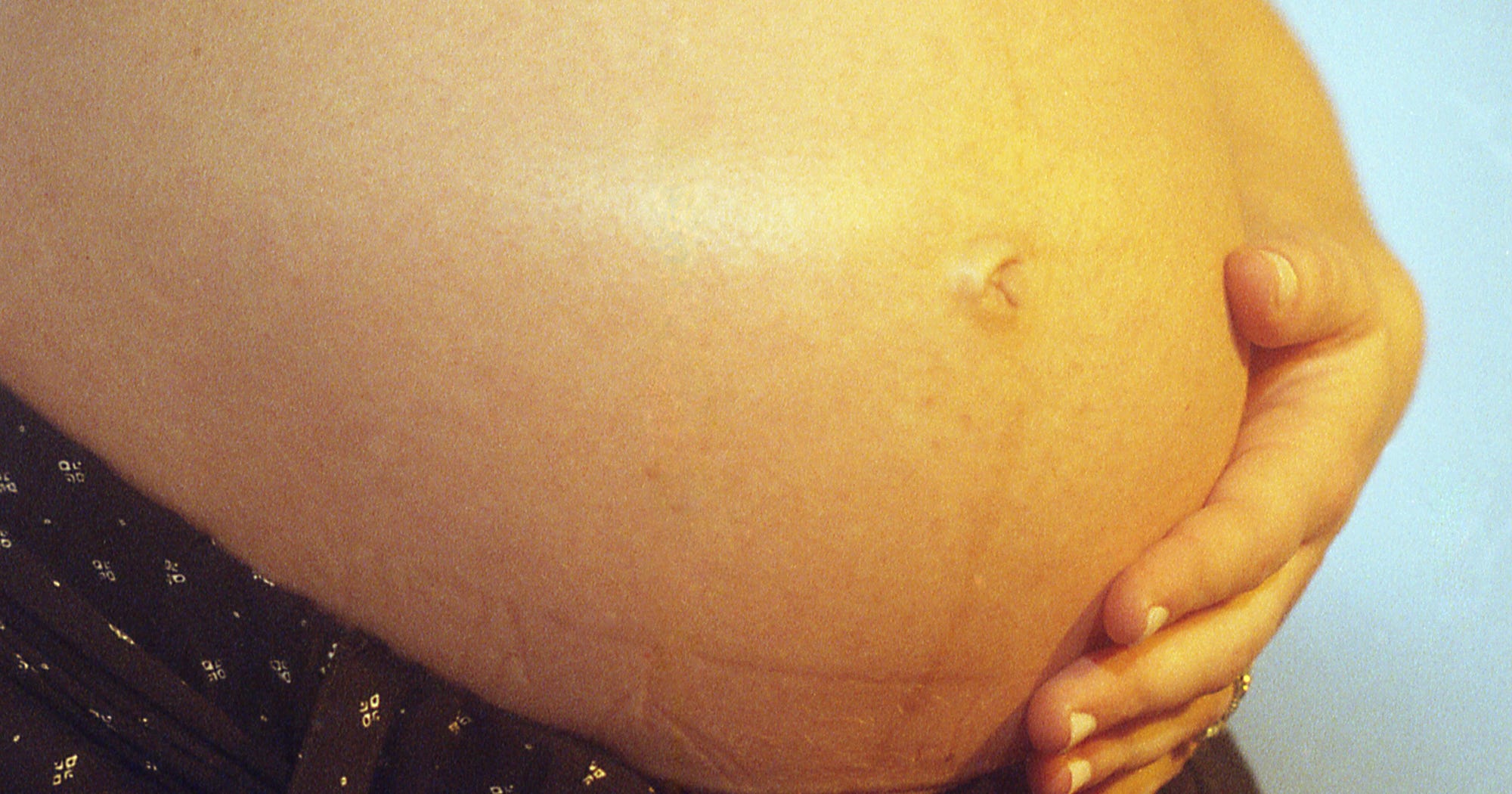 Acne During Pregnancy: Causes & Safe Ways To Treat Skin