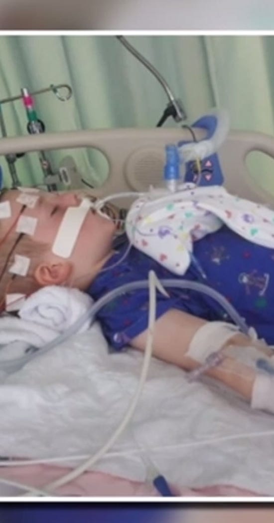 AFM Illness Paralysis Children Acute Flaccid Myelitis