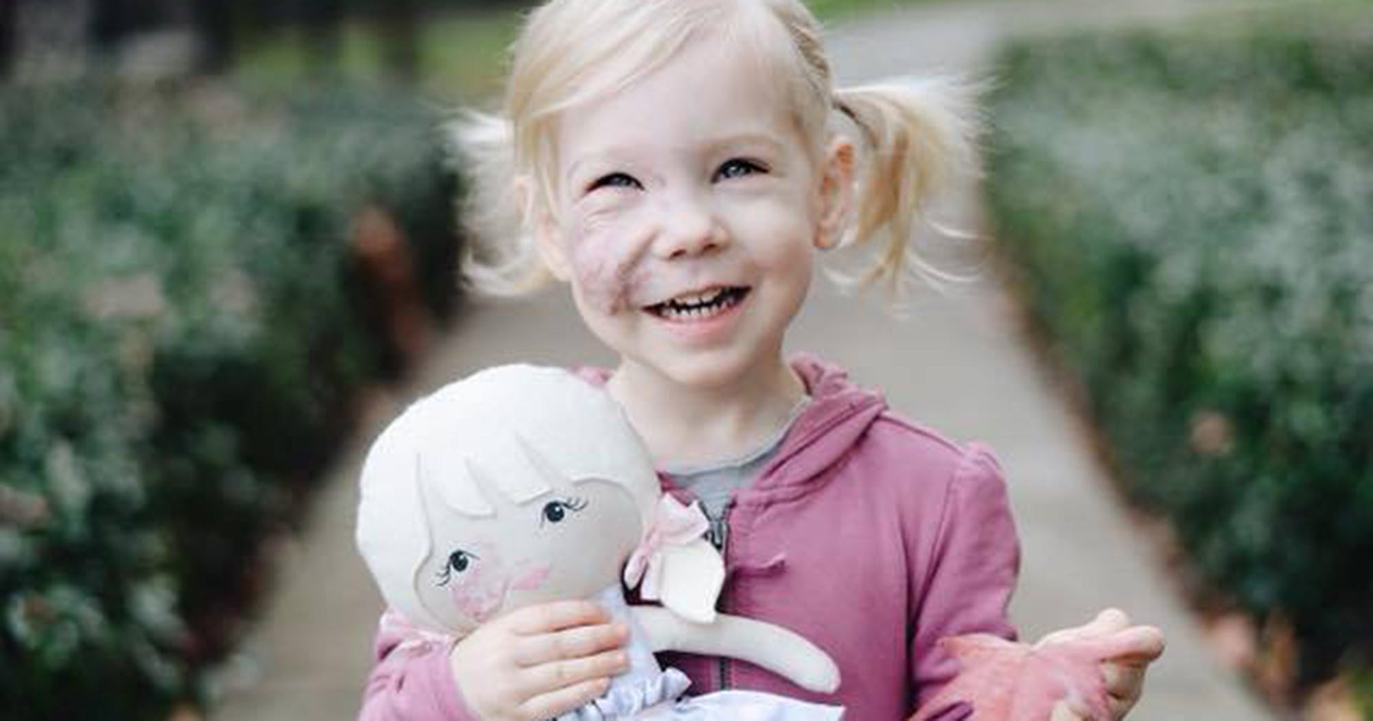 Doll With Face Birthmark Special Christmas Gift