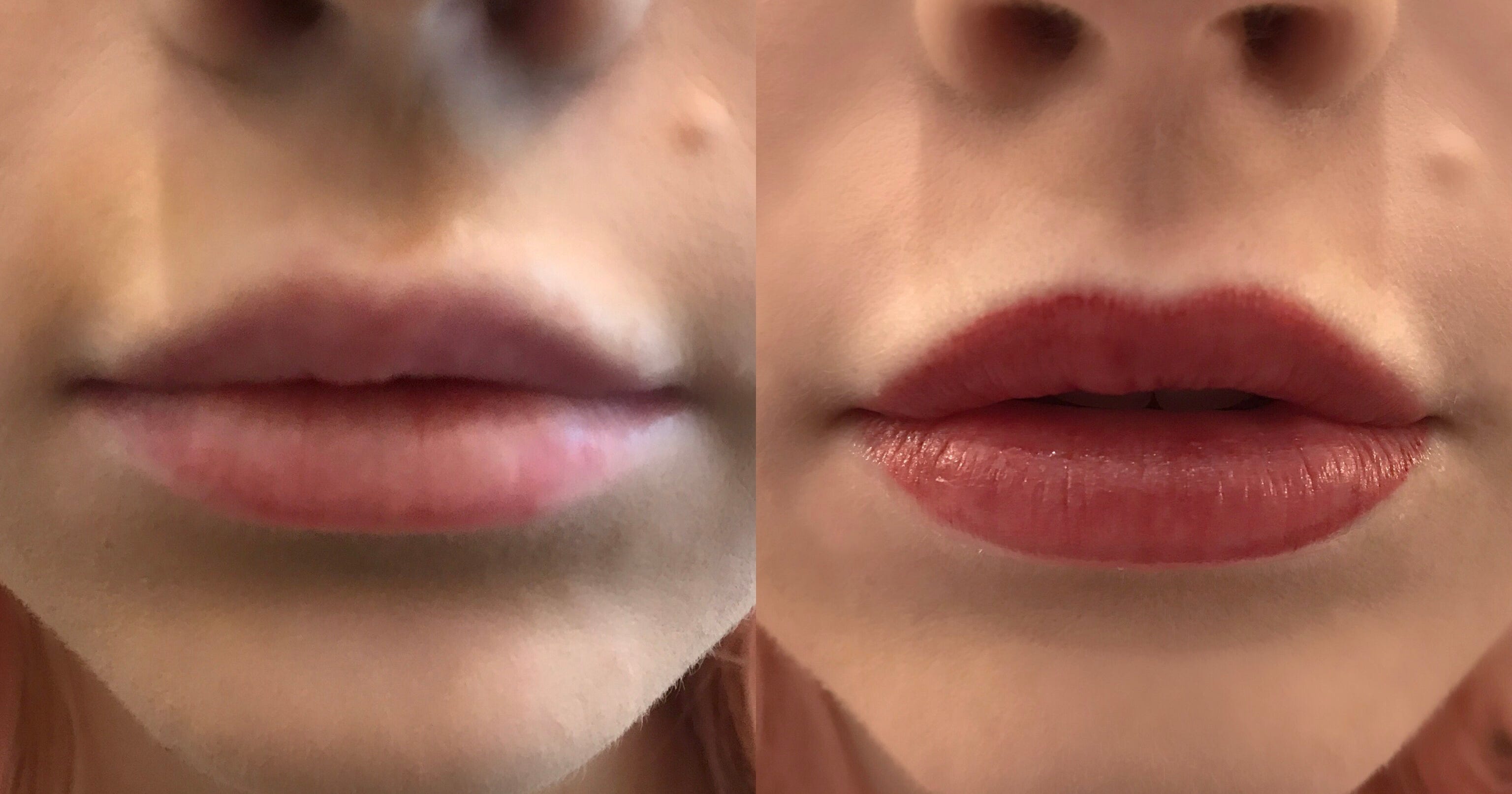 Permanent Lip Color Tattoo Experience Photos