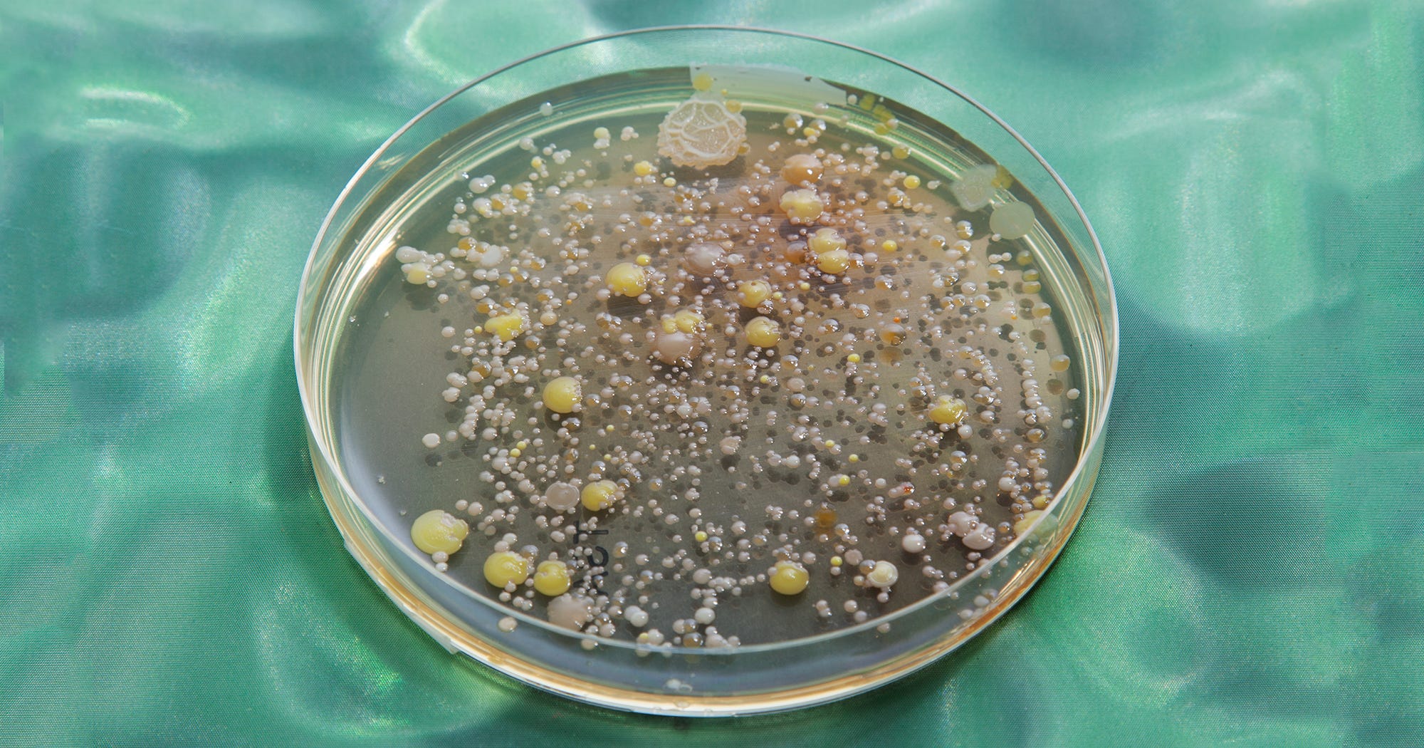 iPhone Screen Germs Study - Gross Phone